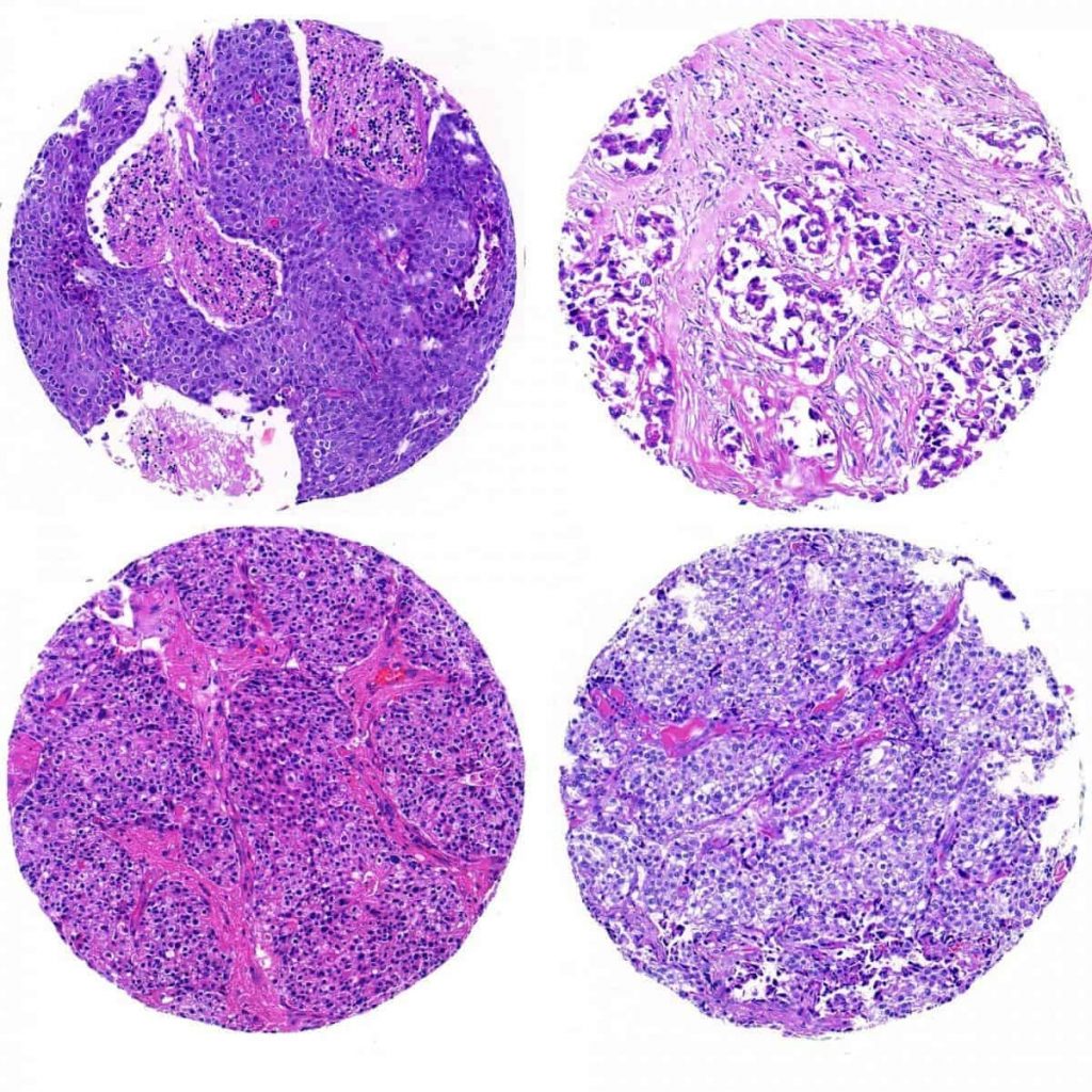Mopec Control Slides: Histology, IHC, TMA & Human Tissue